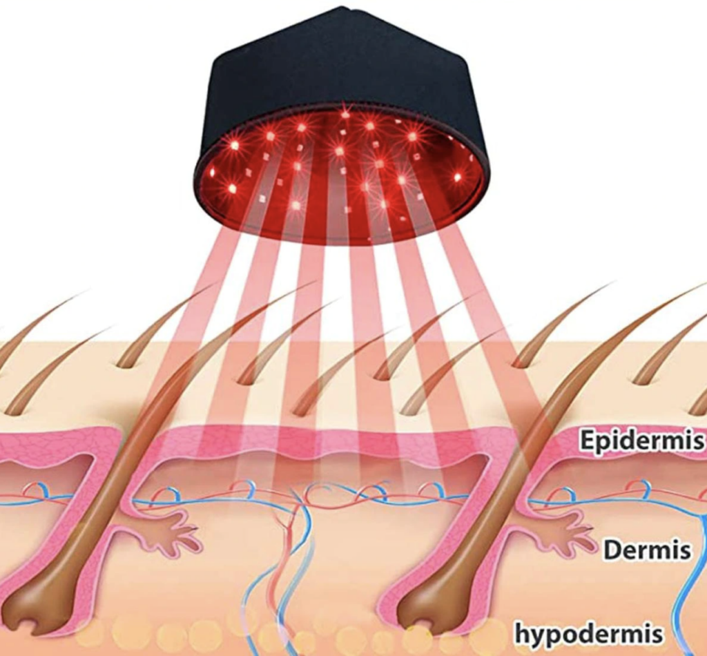 Red Light Therapy vs. Other Hair Loss Treatments: Making an Informed ...